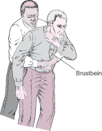 Notfälle und Verletzungen - MSD Manual Ausgabe für Patienten