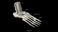 Fractures du pied - Lésions et intoxications - Manuels MSD pour le ...