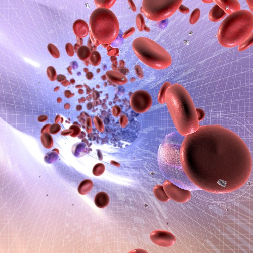 High White Blood Cell Count - Blood Disorders - MSD Manual Consumer Version